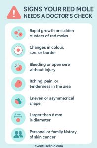 Red Mole on Skin: How to Tell Cherry Angioma from Melanoma