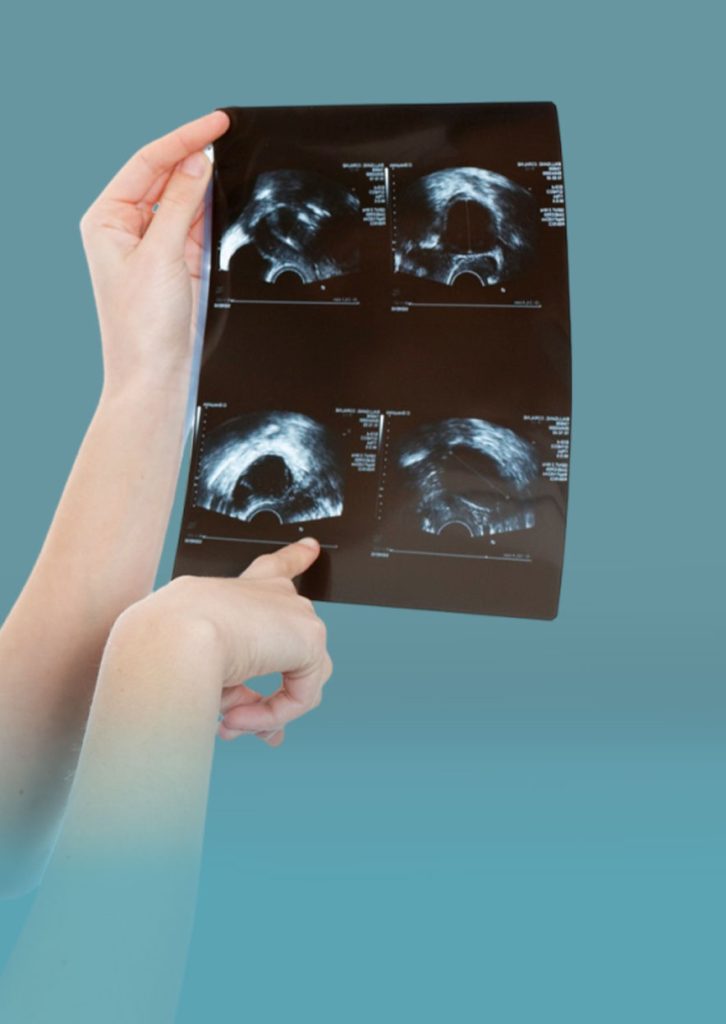 Soft Tissue Ultrasound Scans For Lumps And Bumps | From £135