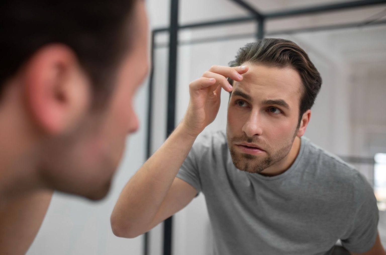 Types of Hairlines in Men & Women: Shapes, Changes & What They Mean