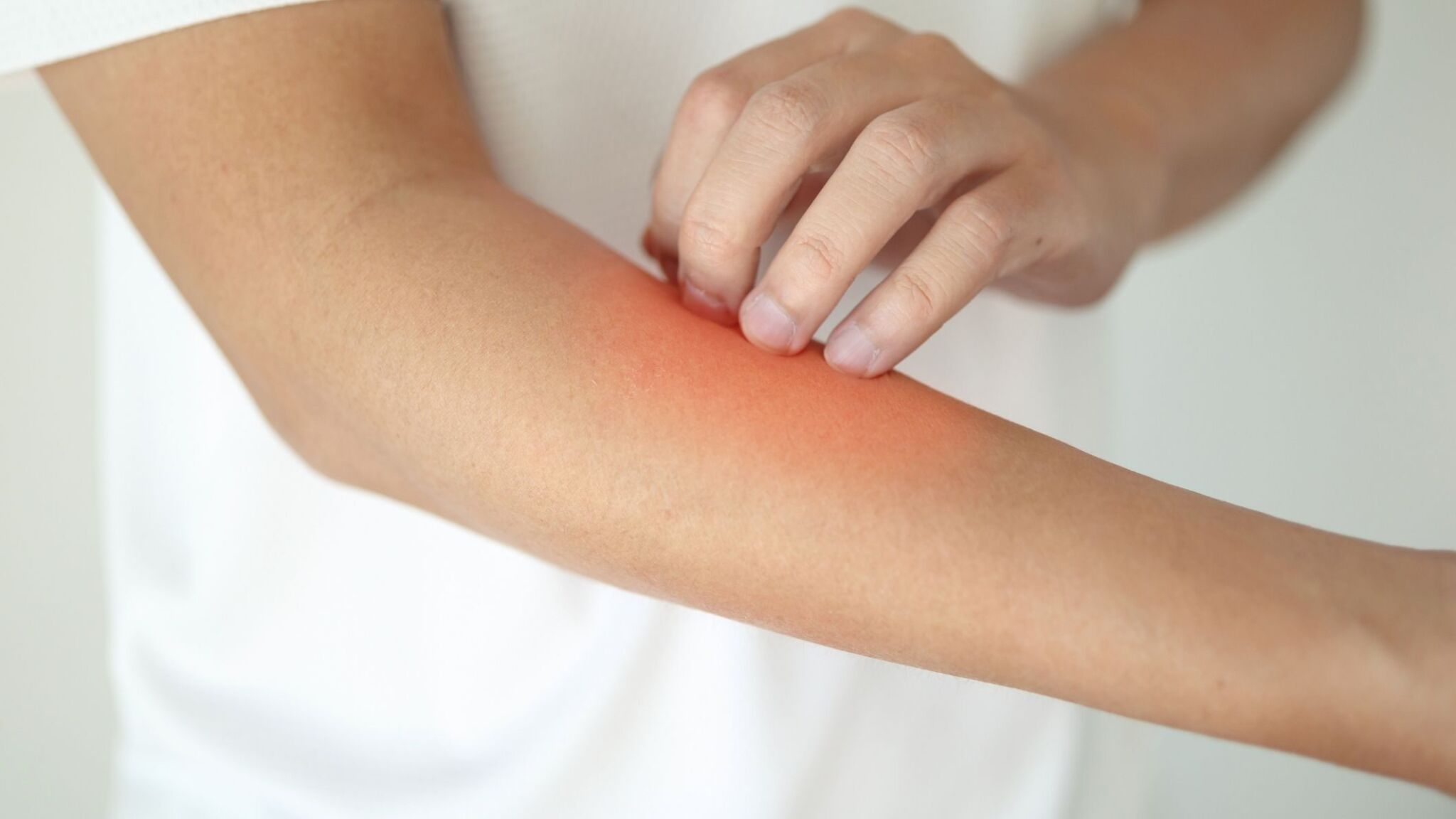 What Happens If You Accidentally Scratch Off A Mole? Don’t Panic!
